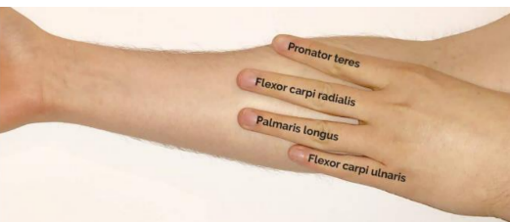 All Upper Limb Pathologies on one page! | MMB • Meducate