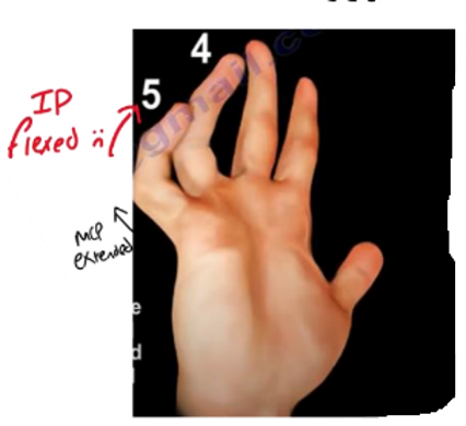All Upper Limb Pathologies on one page! | MMB • Meducate