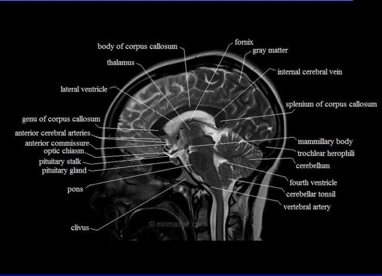 Neuroanatomy Summary • Meducate