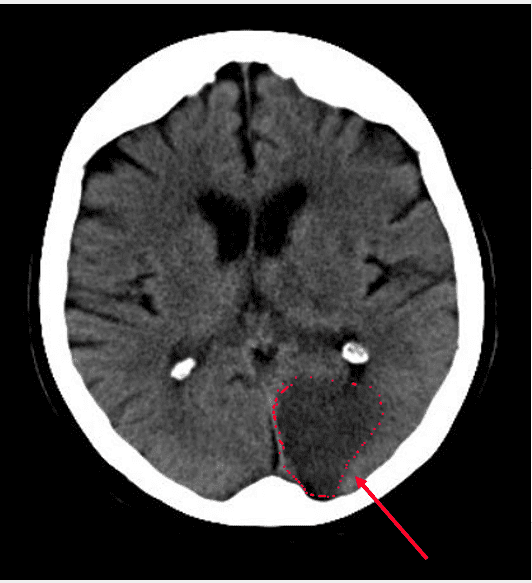 Neuroanatomy Summary • Meducate