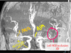Neuroanatomy Summary • Meducate