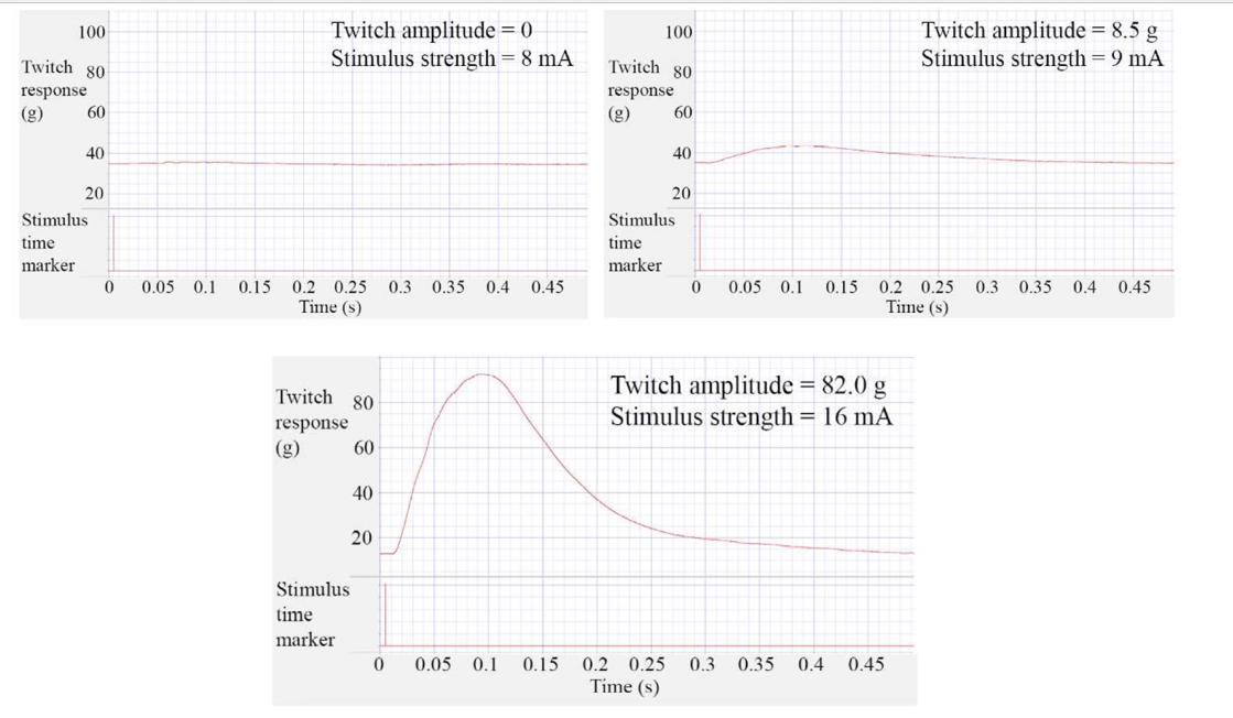 Y2 OCaPE: MMB 4 - Muscle Electrics Lab • Meducate